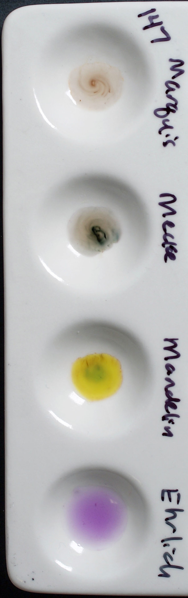 DrugsData.org (was EcstasyData): Test Details : Result #14084 - LSD ...