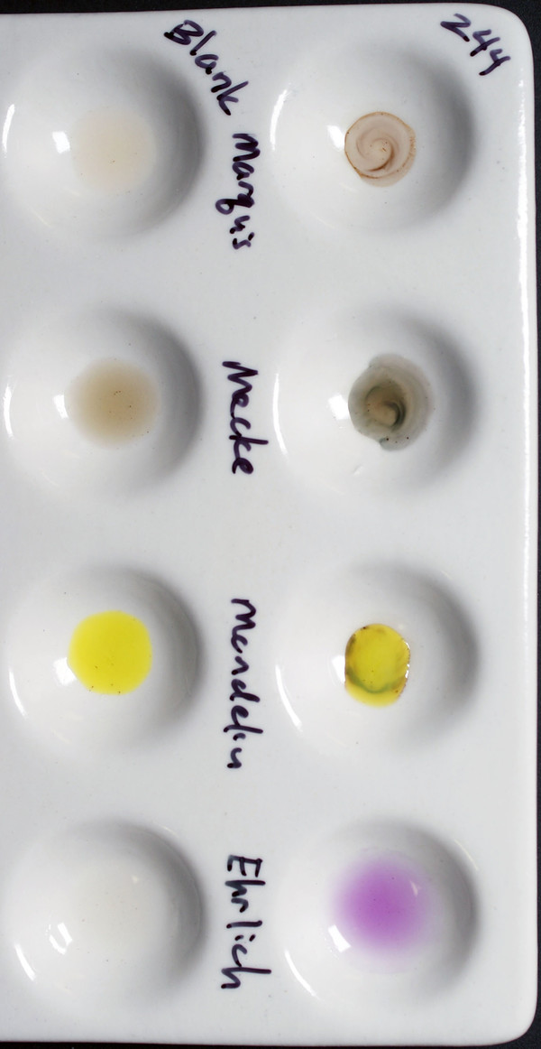 DrugsData.org (was EcstasyData): Test Details : Result #14213 - Sandoz ...