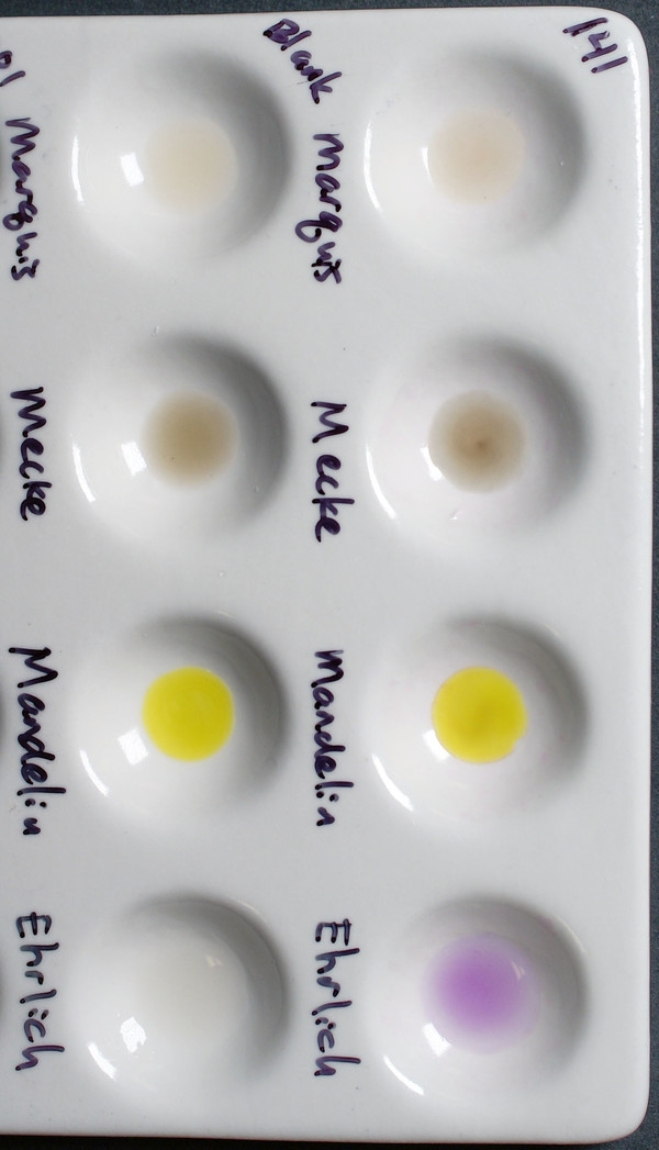 DrugsData.org (was EcstasyData): Test Details : Result #14404 - LSD ...