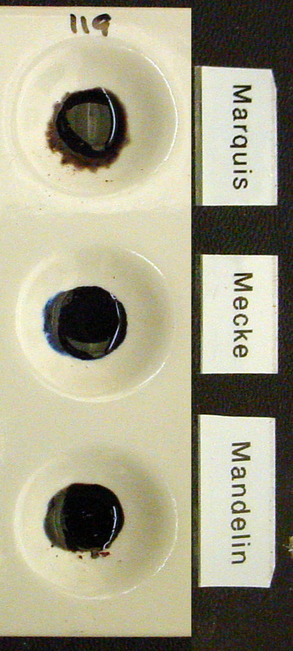 DrugsData.org (was EcstasyData): Test Details : Result #3304 - Purple ...