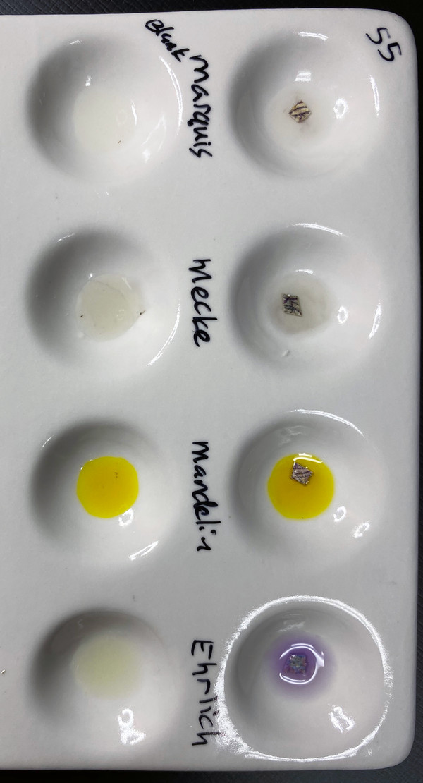 DrugsData.org (was EcstasyData): Test Details : Result #8440 - LSD ...