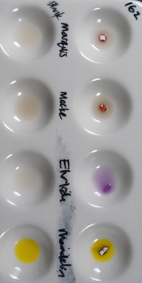 DrugsData.org (was EcstasyData): Test Details : Result #8911 ...